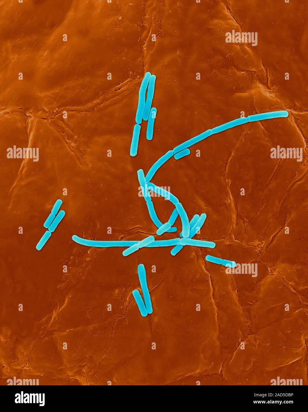 Coloured scanning electron micrograph (SEM) of Bacillus anthracis ...