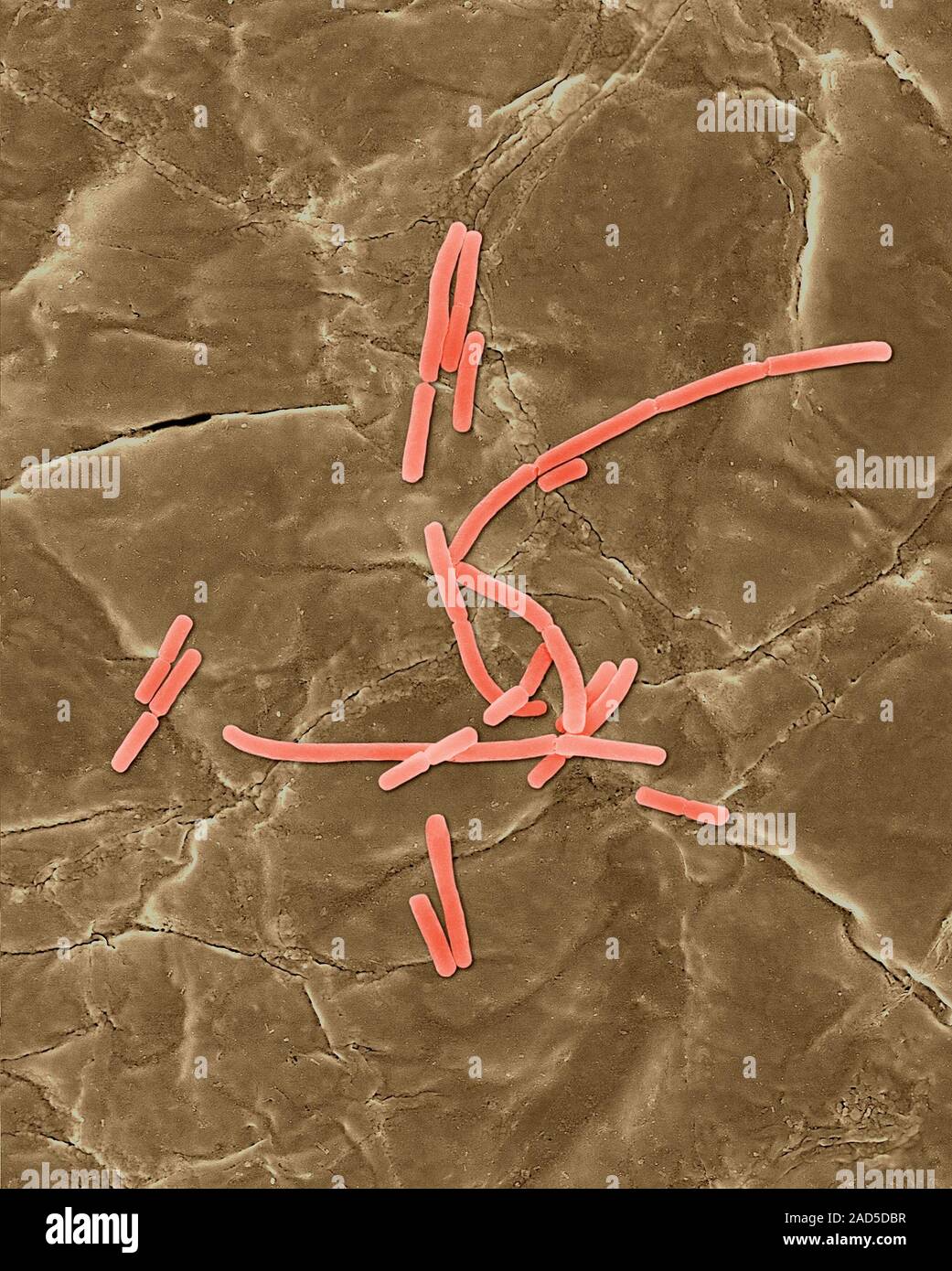 Coloured scanning electron micrograph (SEM) of Bacillus anthracis ...