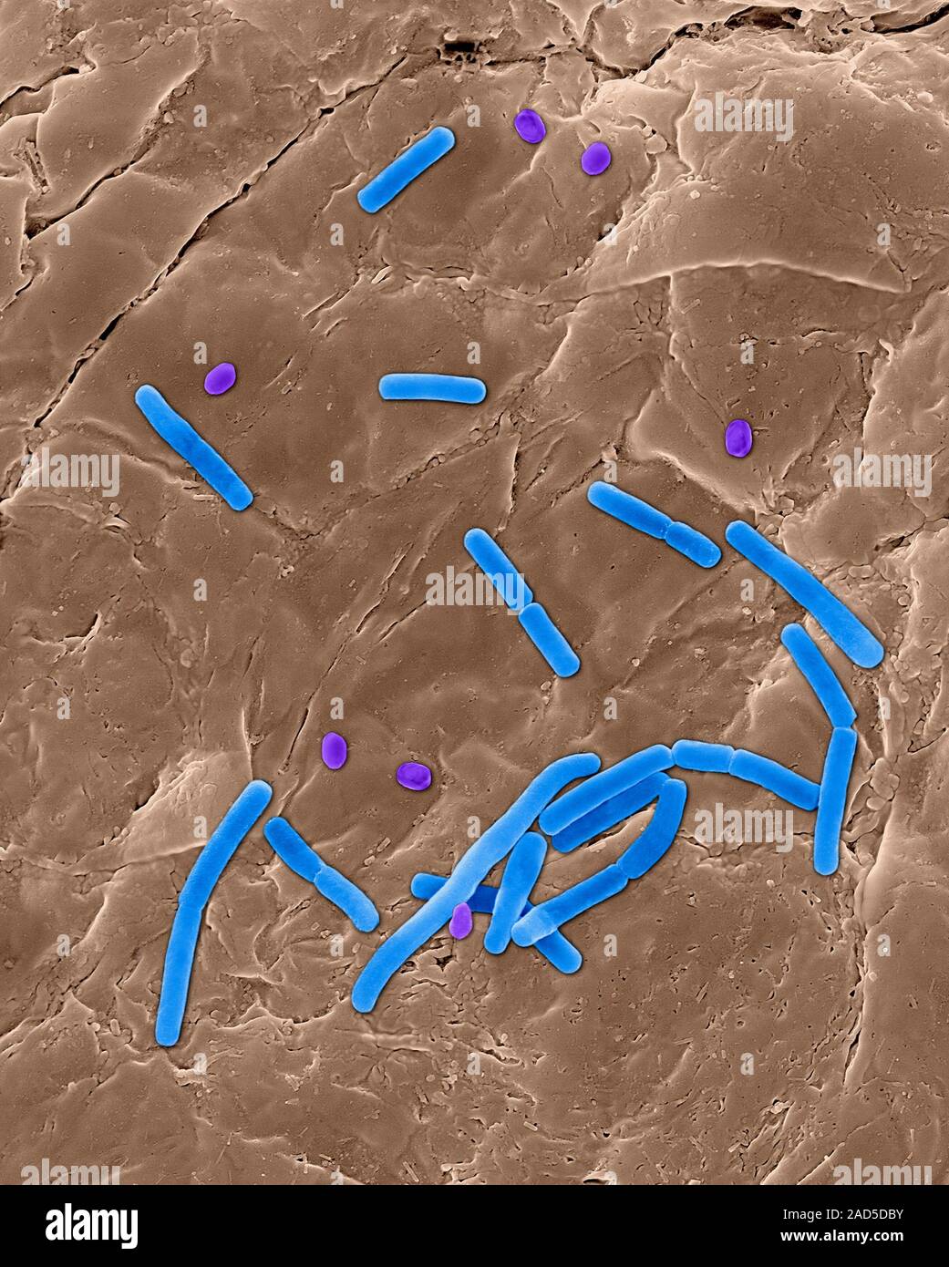 Coloured scanning electron micrograph (SEM) of Bacillus anthracis spore ...
