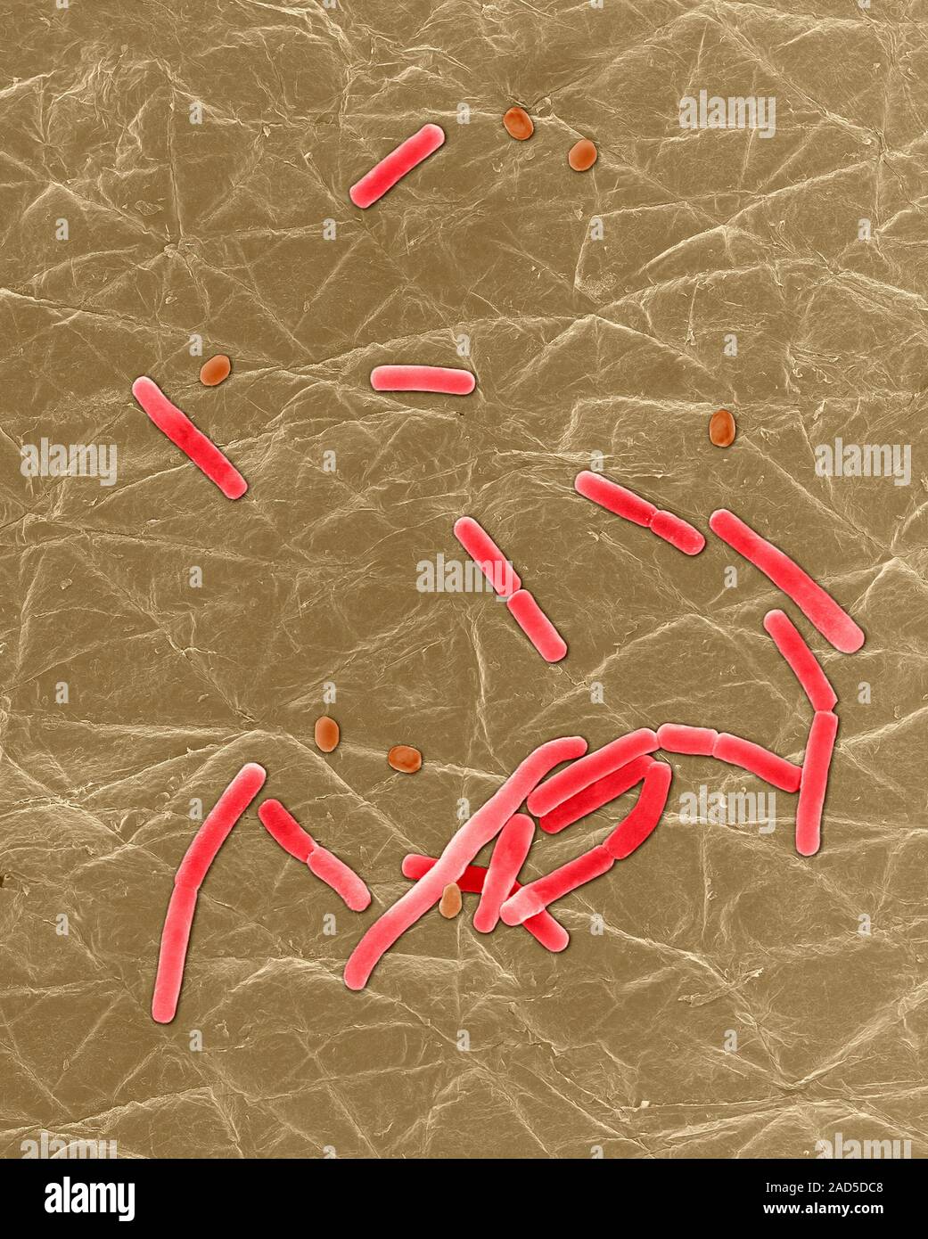 Coloured scanning electron micrograph (SEM) of Bacillus anthracis spore ...