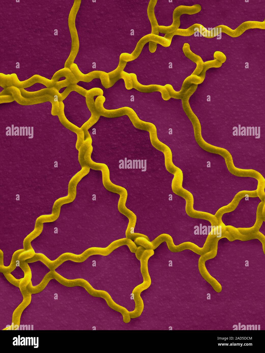 Leptospira Interrogans Gram Stain