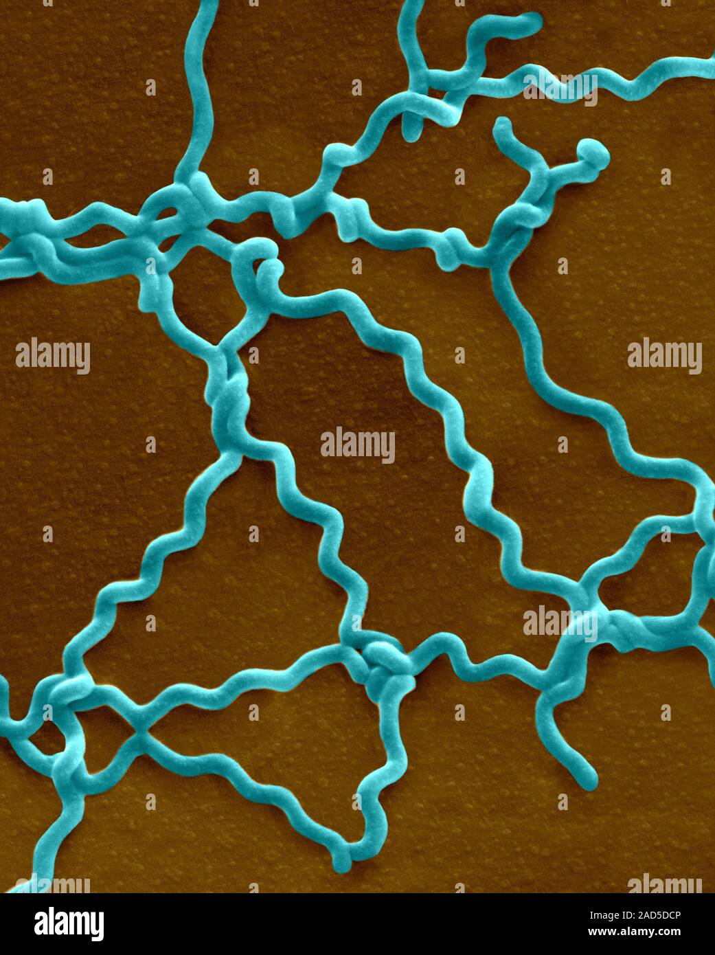Coloured scanning electron micrograph (SEM) of Leptospira interrogans ...