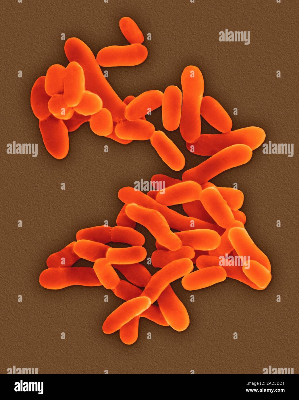 Coloured scanning electron micrograph (SEM) of Mycobacterium tuberculosis is a primary causative ...