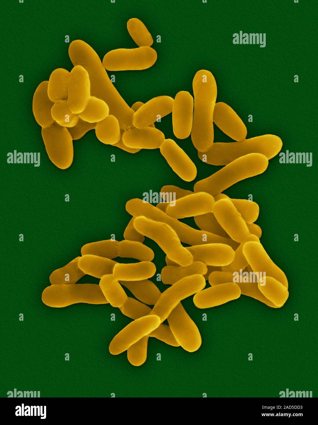 Coloured scanning electron micrograph (SEM) of Mycobacterium tuberculosis is a primary causative ...