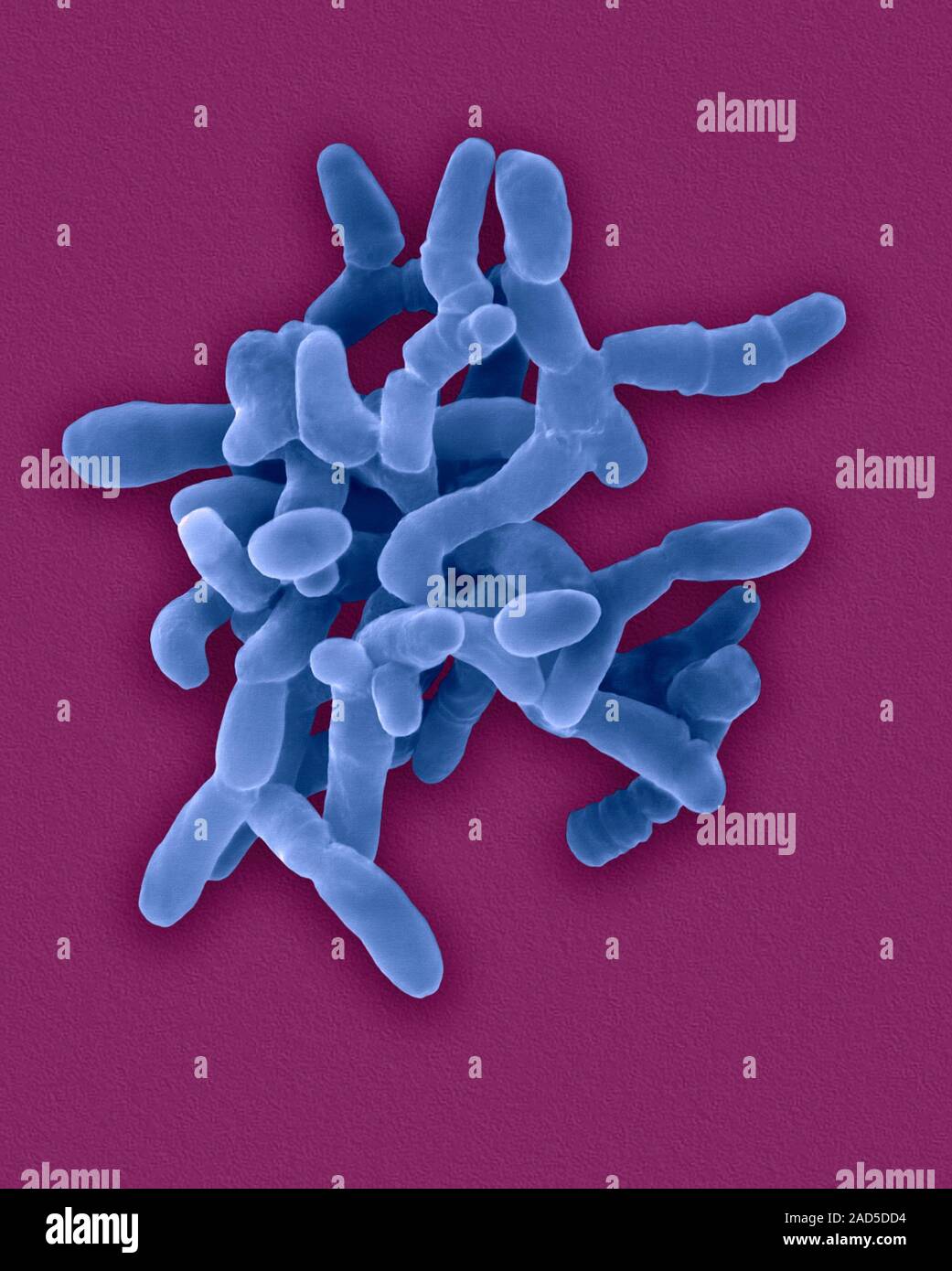 Coloured scanning electron micrograph (SEM) of Mycobacterium ...