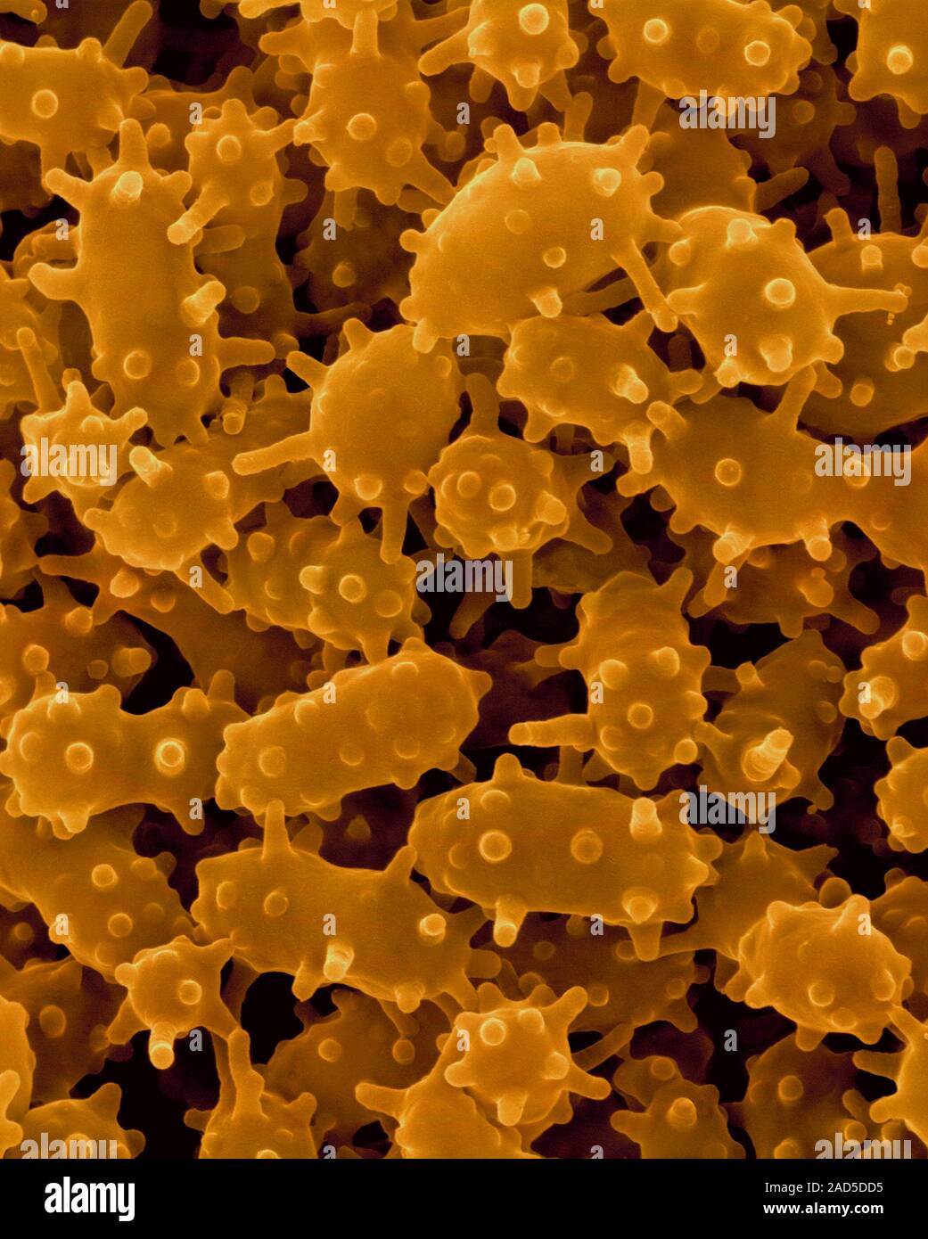 Coloured scanning electron micrograph (SEM) of Verrucomicrobium ...