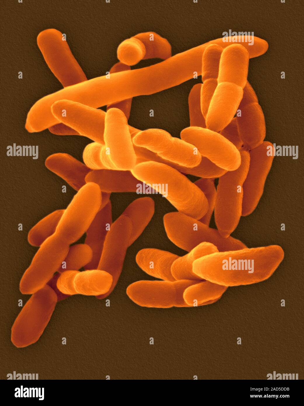 Coloured scanning electron micrograph (SEM) of Arthrobacter sp., Gram ...