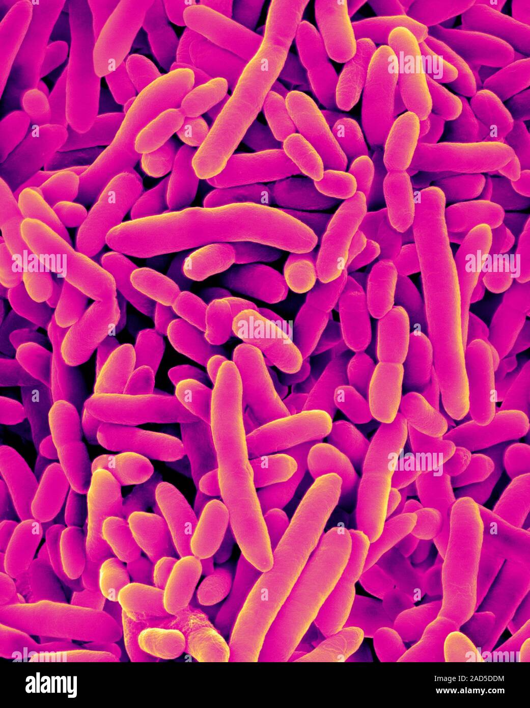 Coloured Scanning Electron Micrograph Sem Of Pseudomonas Putida Gram Negative Aerobic