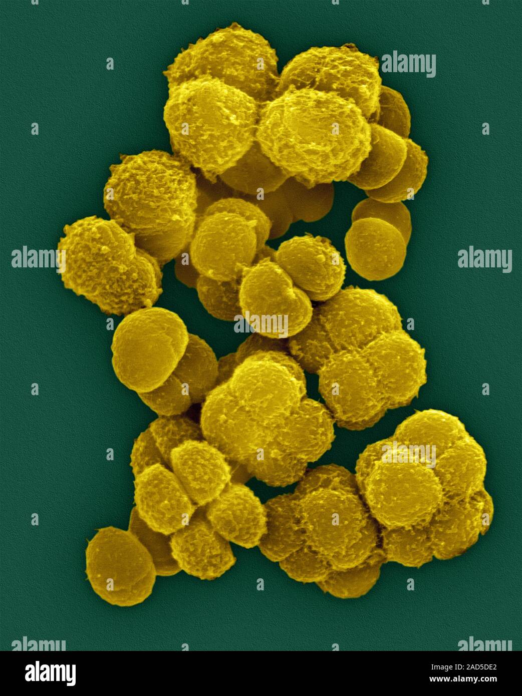 Coloured scanning electron micrograph (SEM) of Deinococcus sp., Coccoid ...