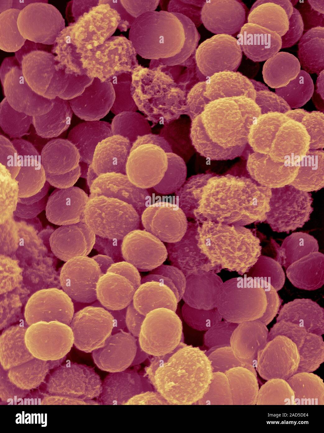 Coloured scanning electron micrograph (SEM) of Deinococcus sp., Coccoid ...