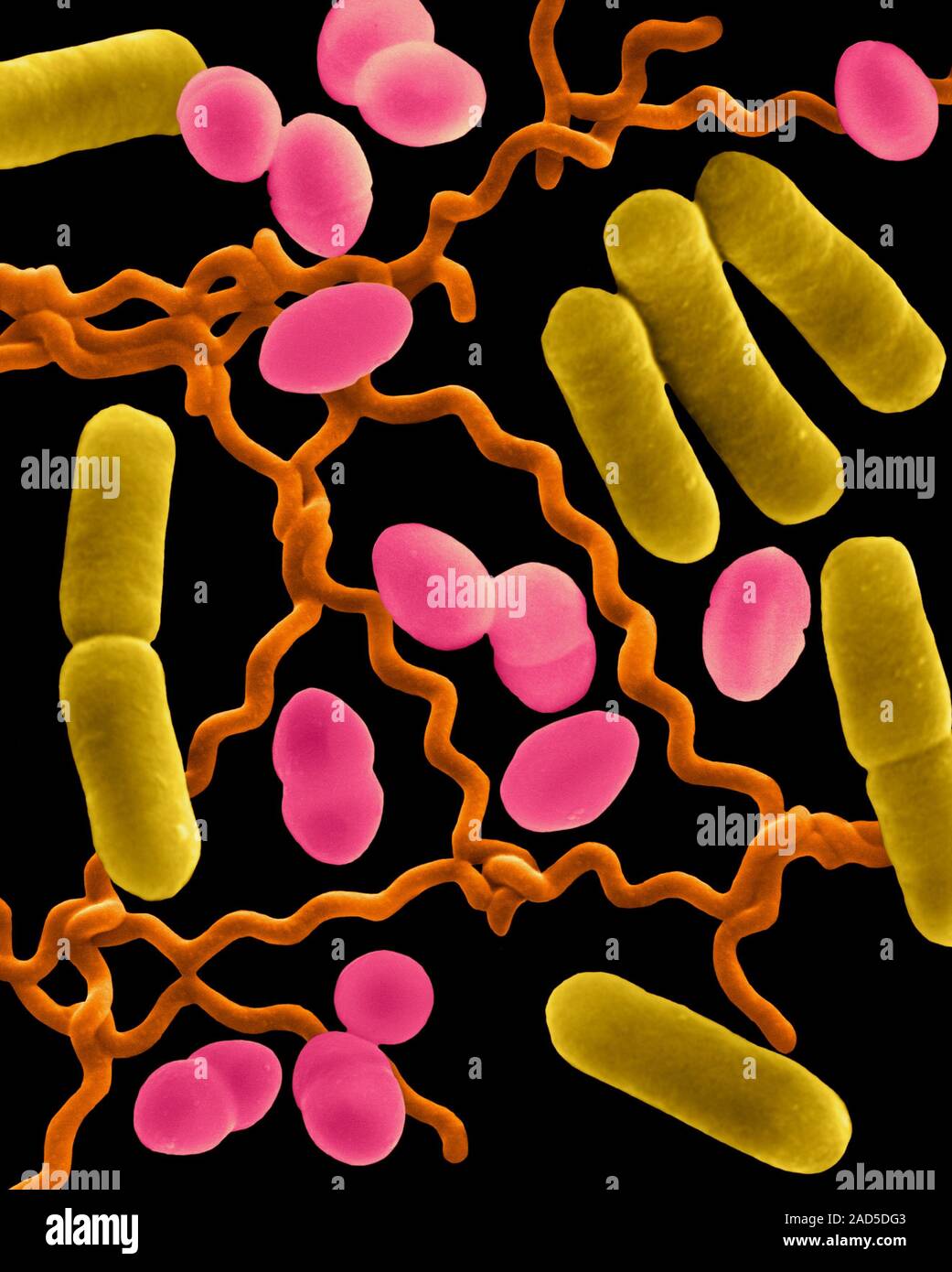 Coloured scanning electron micrograph (SEM) of Photocomposite of the ...