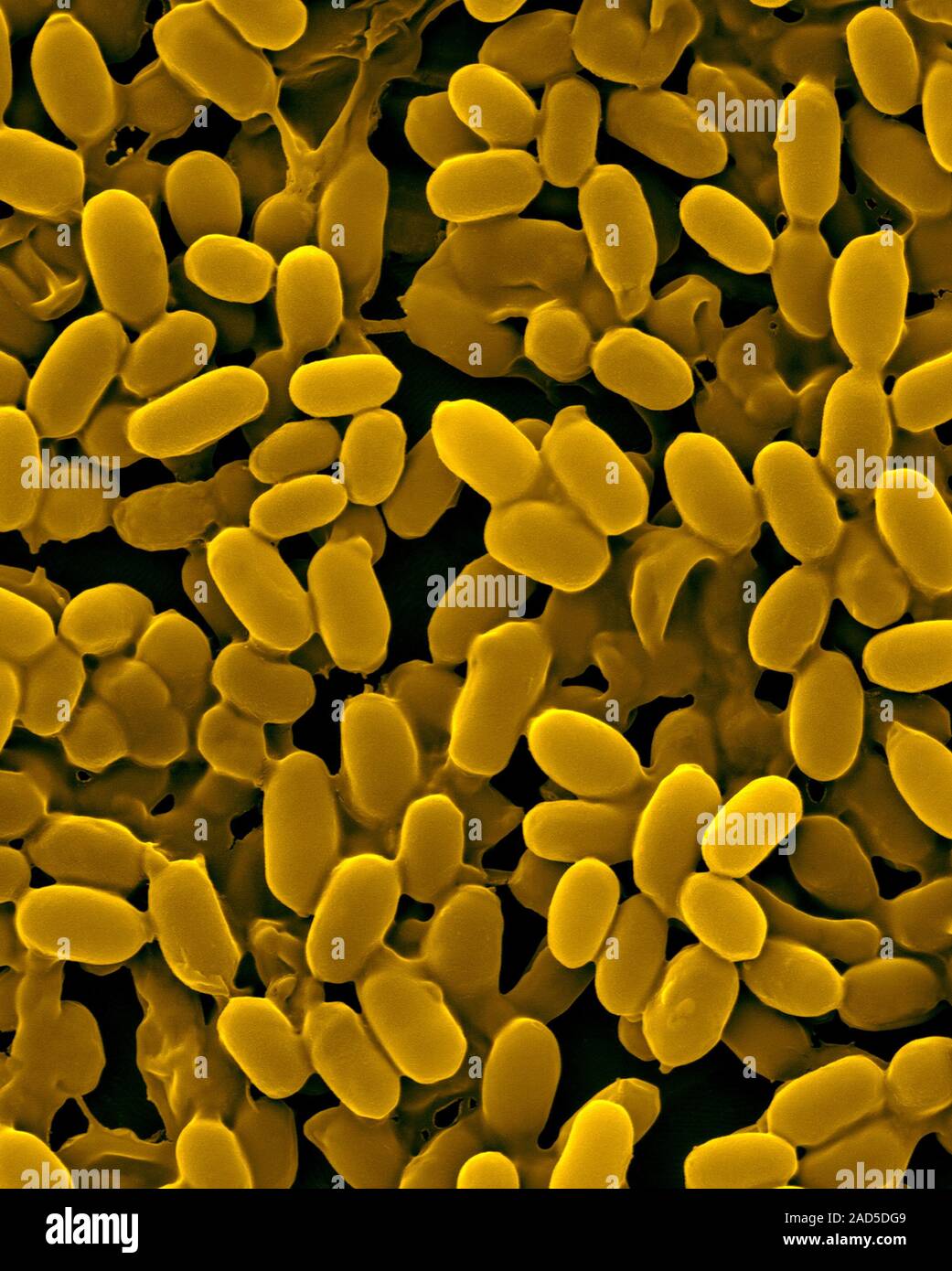 Coloured scanning electron micrograph (SEM) of Pasteurella multocida is ...