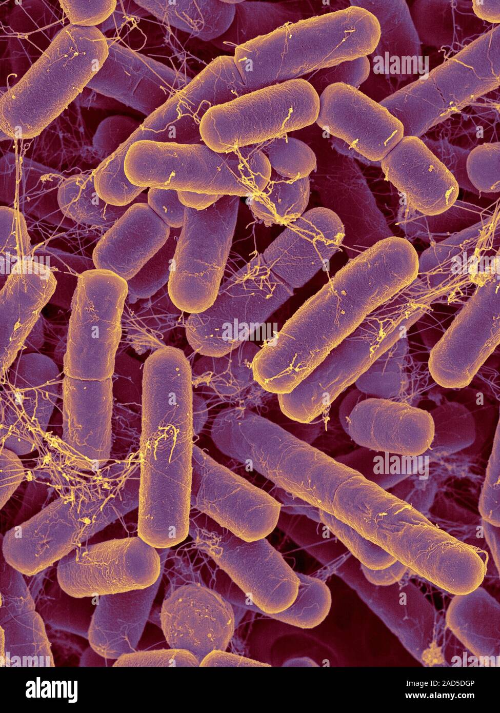 Coloured scanning electron micrograph (SEM) of Bacteroides sp., rod ...