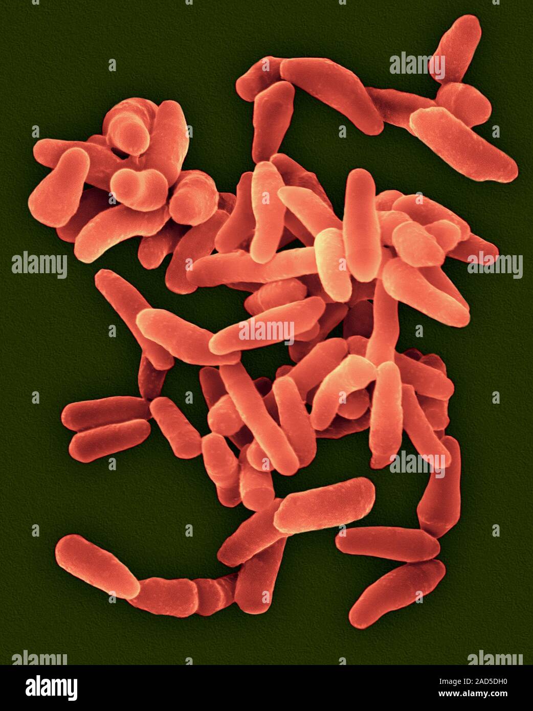 Coloured scanning electron micrograph (SEM) of Coxiella burnetii, gram ...