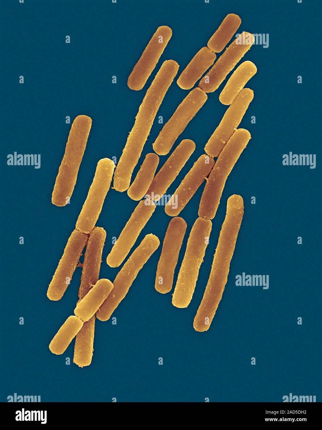 Coloured scanning electron micrograph (SEM) of Clostridium difficile ...