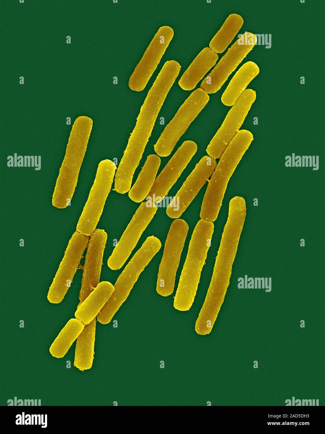 Coloured scanning electron micrograph (SEM) of Clostridium difficile ...