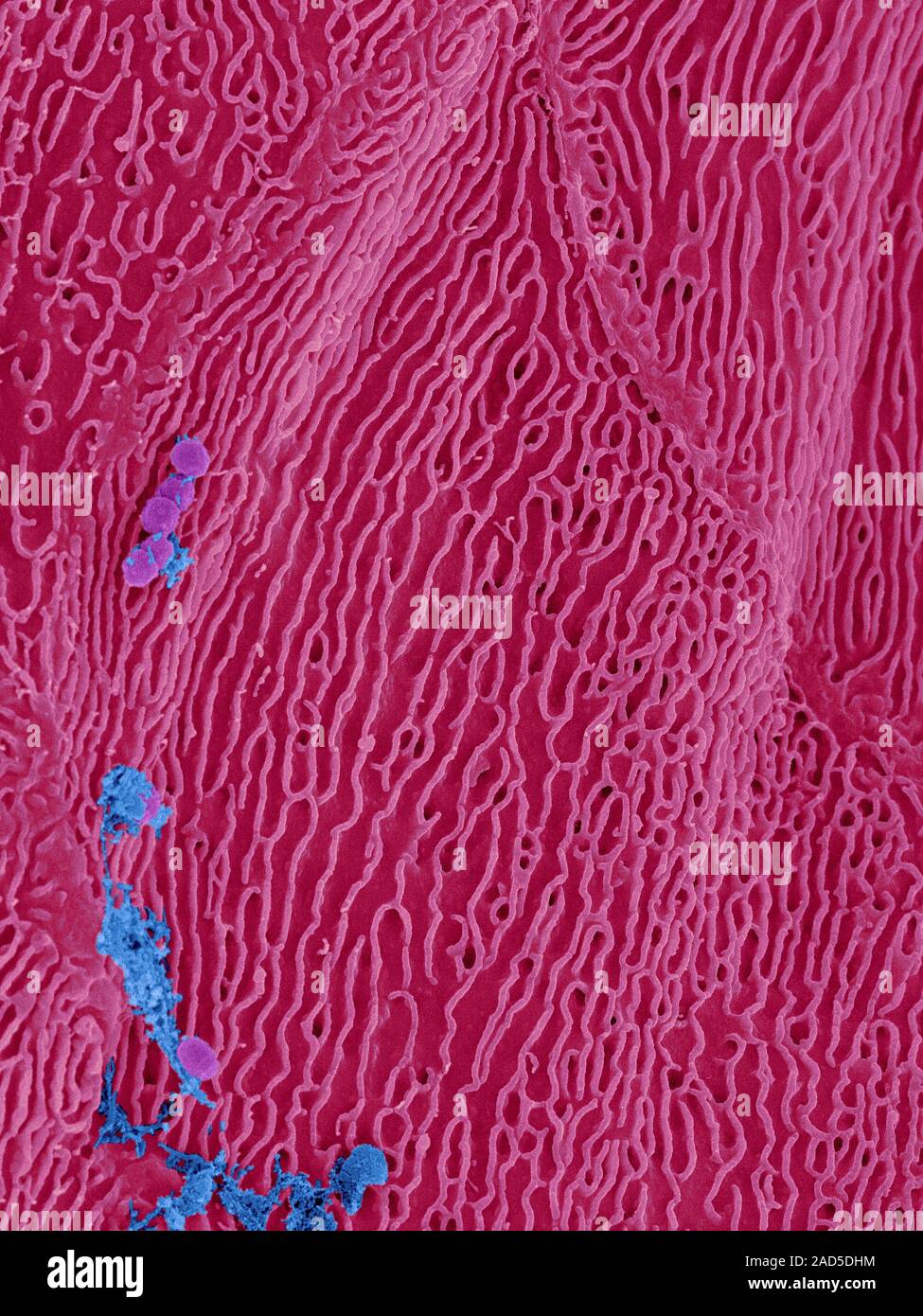 Coloured scanning electron micrograph (SEM) of Bacteria on an ...