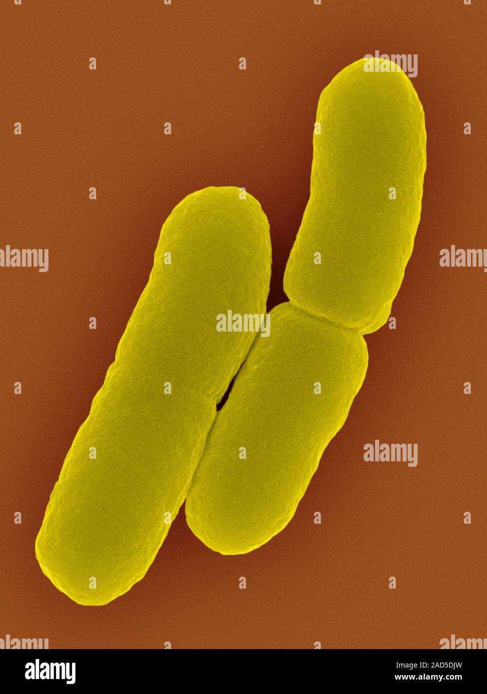 Coloured scanning electron micrograph (SEM) of E. coli (Escherichia ...