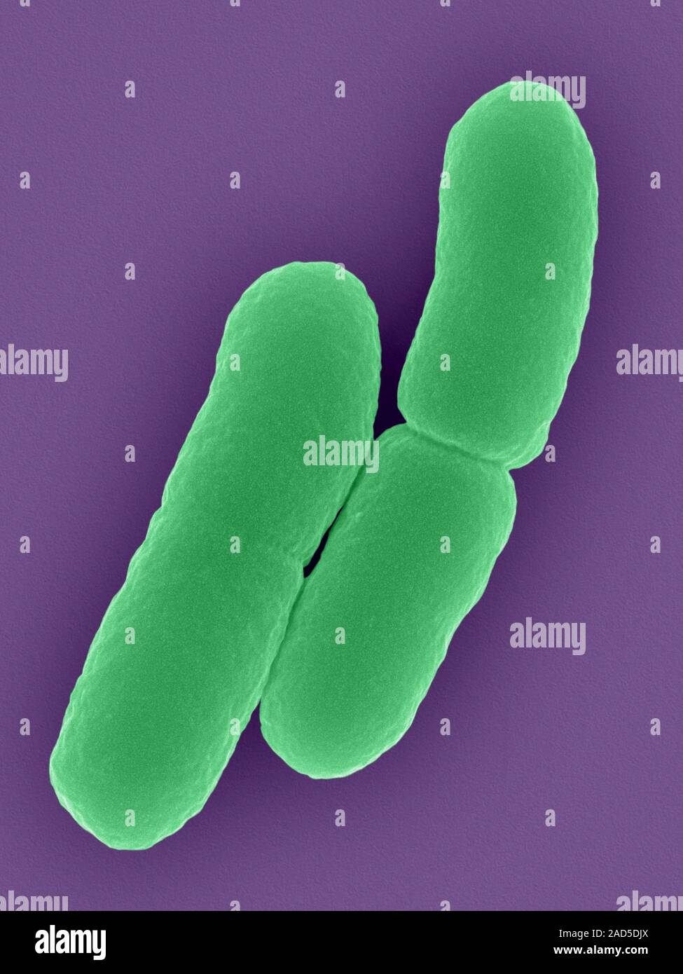 Coloured scanning electron micrograph (SEM) of E. coli (Escherichia ...