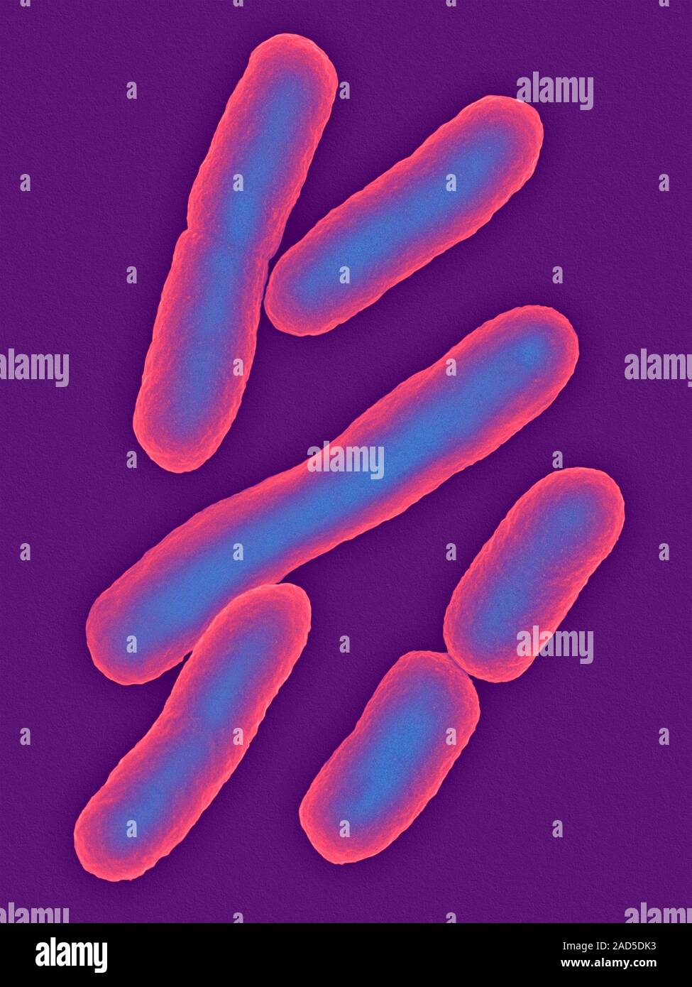 Coloured scanning electron micrograph (SEM) of Escherichia coli ...