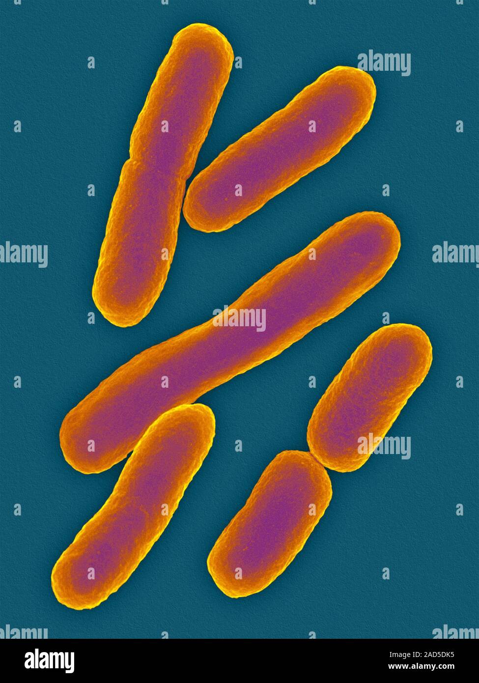 Coloured scanning electron micrograph (SEM) of Escherichia coli ...