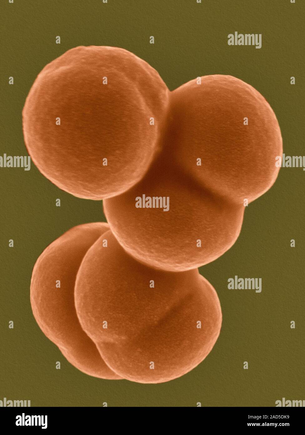 Coloured scanning electron micrograph (SEM) of Staphylococcus aureus ...