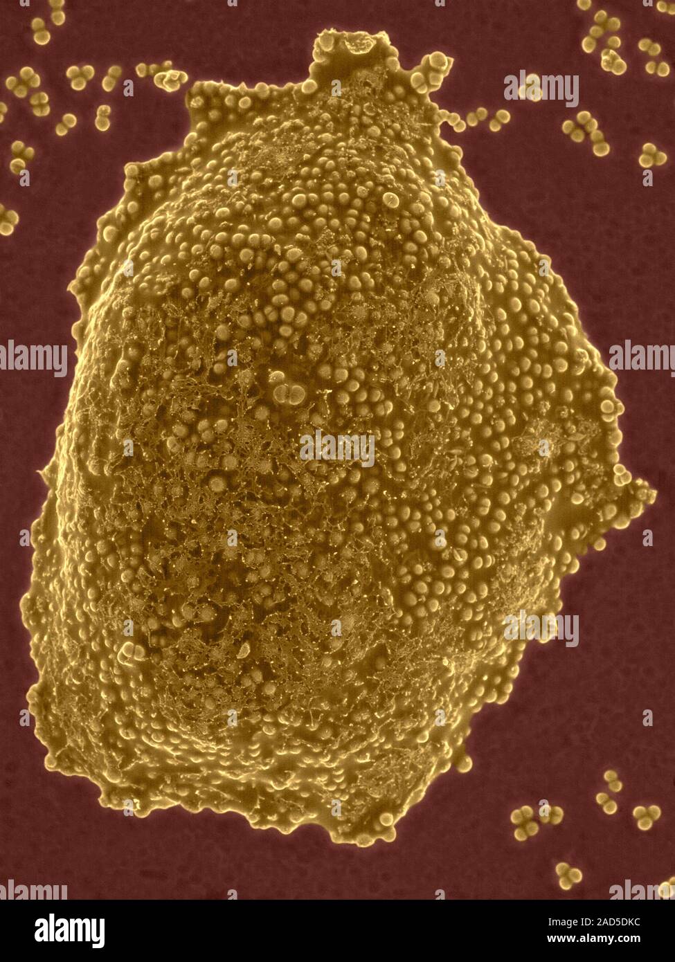 Coloured scanning electron micrograph (SEM) of Staphylococcus aureus ...