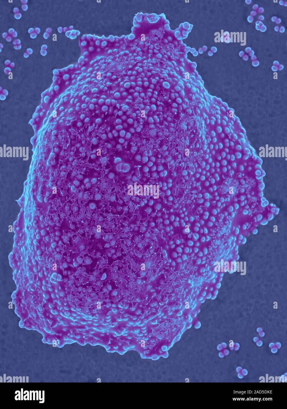 Coloured scanning electron micrograph (SEM) of Staphylococcus aureus ...
