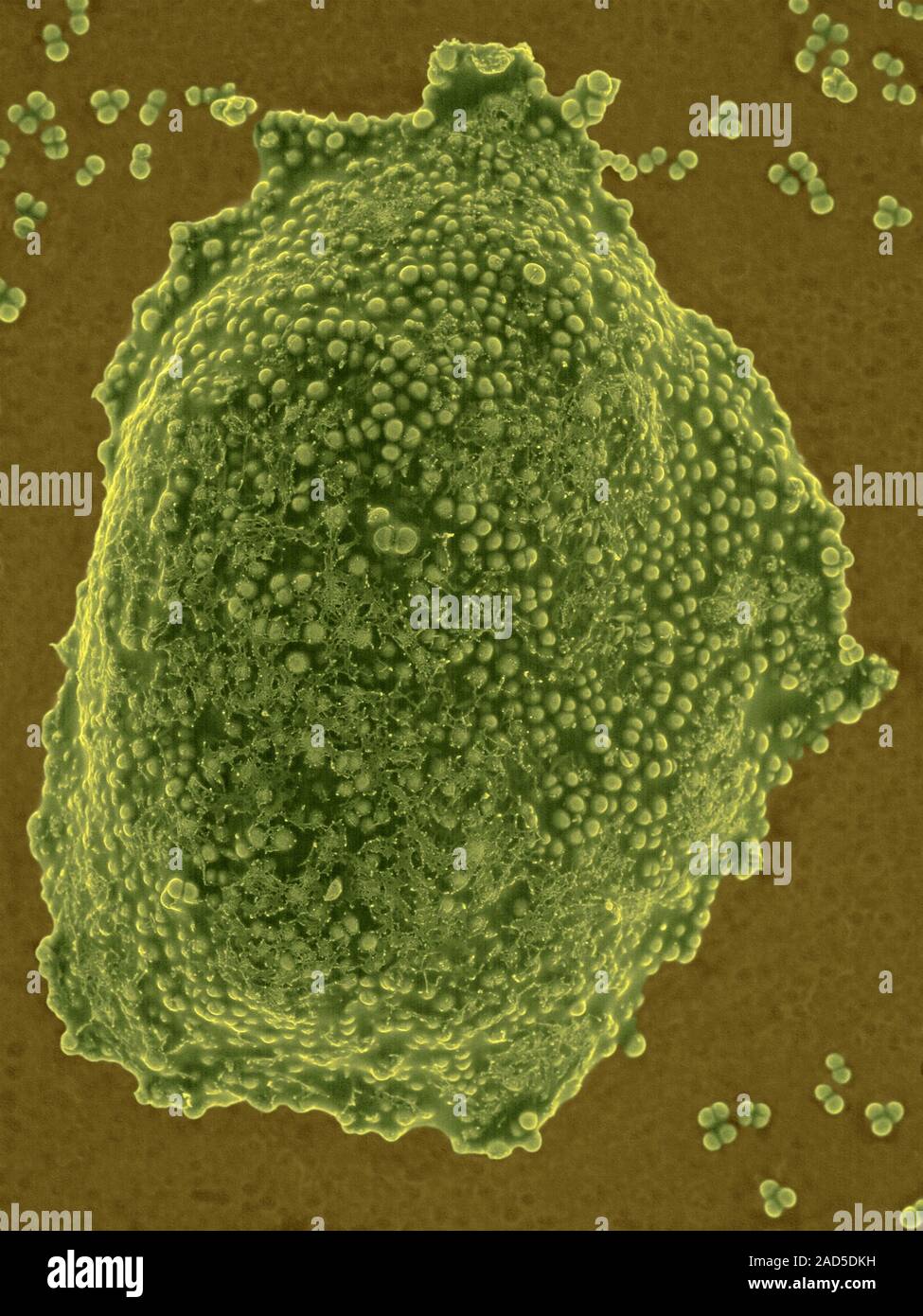 Coloured scanning electron micrograph (SEM) of Staphylococcus aureus ...