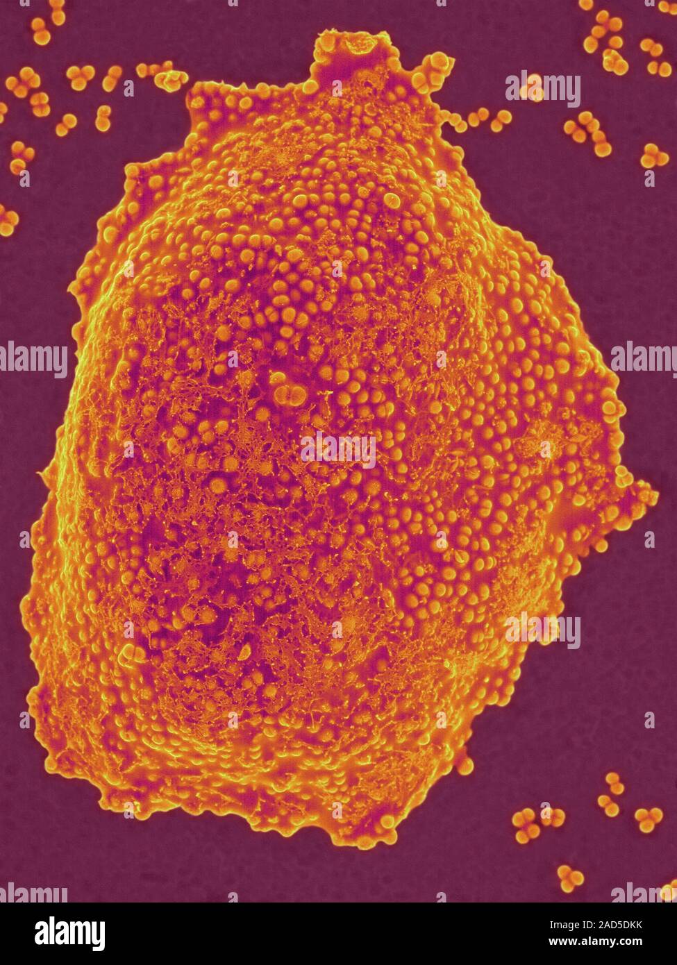 Coloured scanning electron micrograph (SEM) of Staphylococcus aureus ...