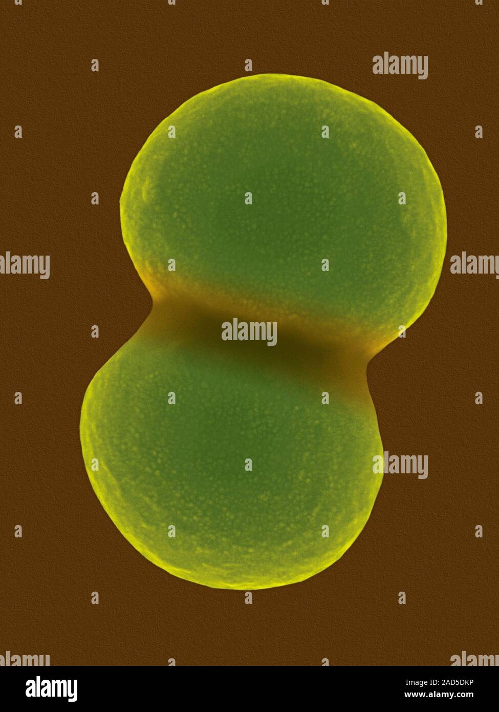 Coloured scanning electron micrograph (SEM) of Staphylococcus aureus ...