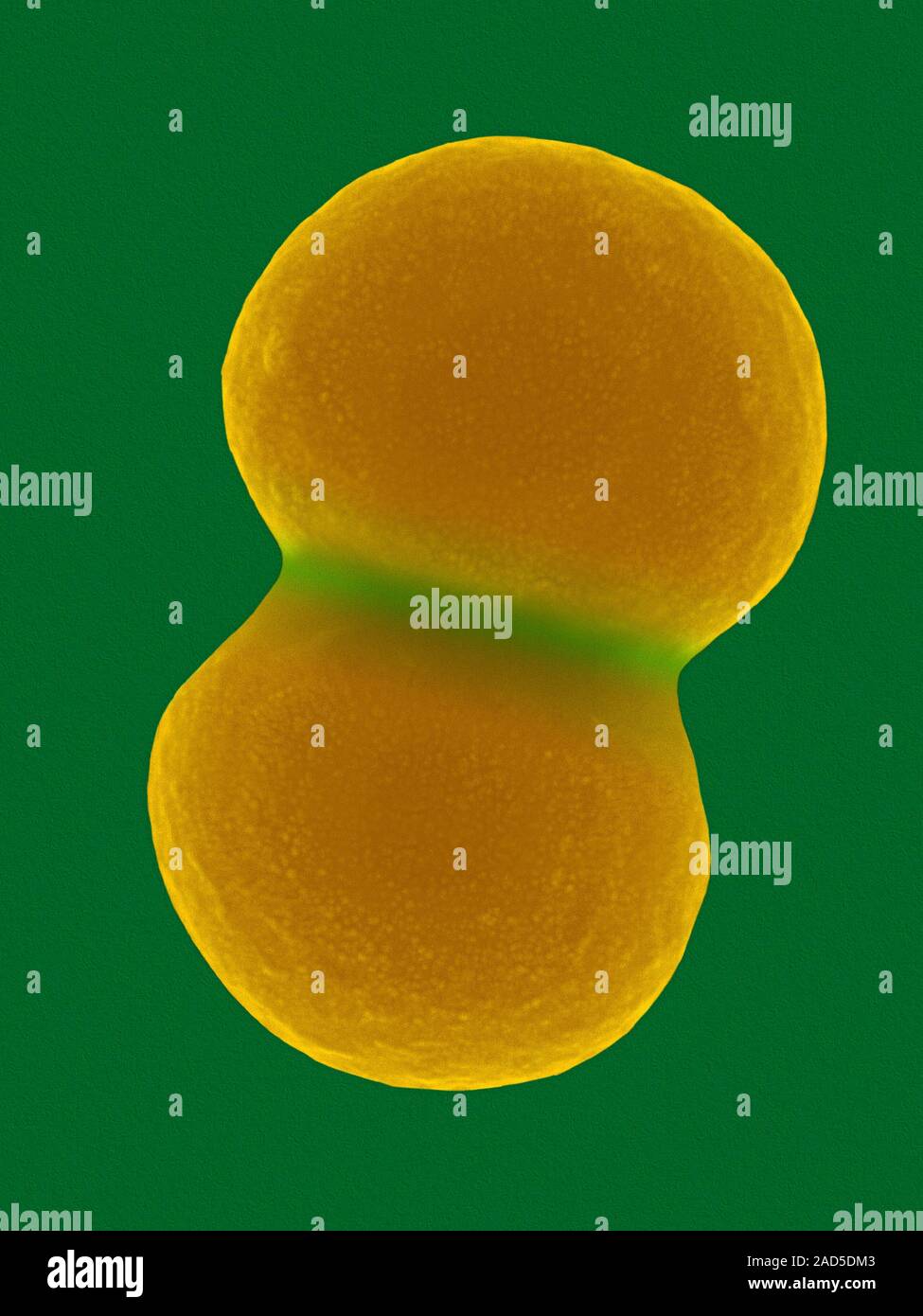 Coloured scanning electron micrograph (SEM) of Staphylococcus aureus ...