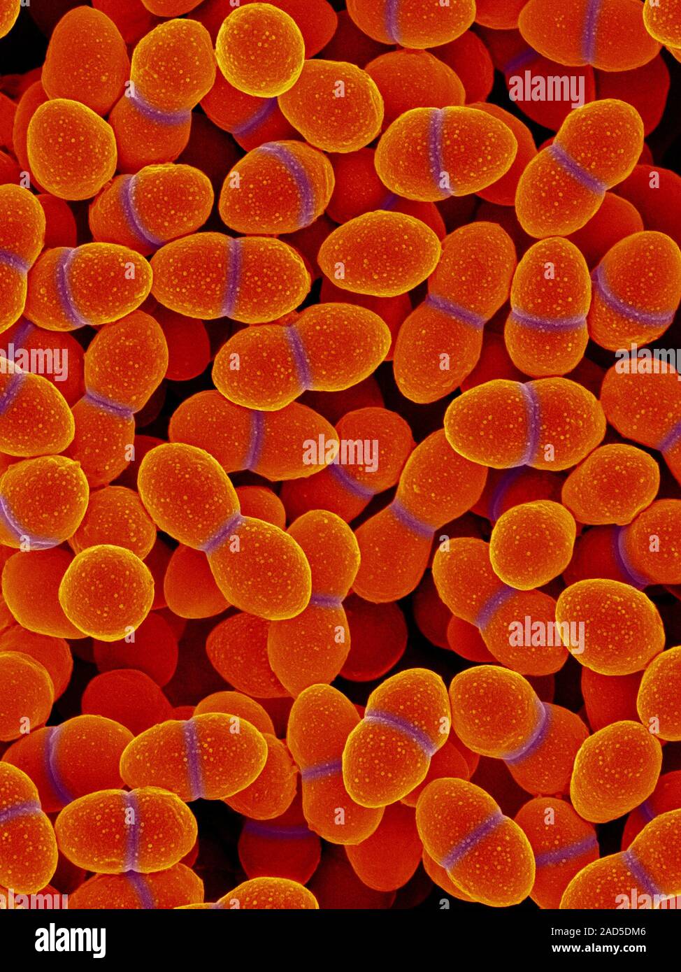 Coloured scanning electron micrograph (SEM) of Enterococcus faecalis ...