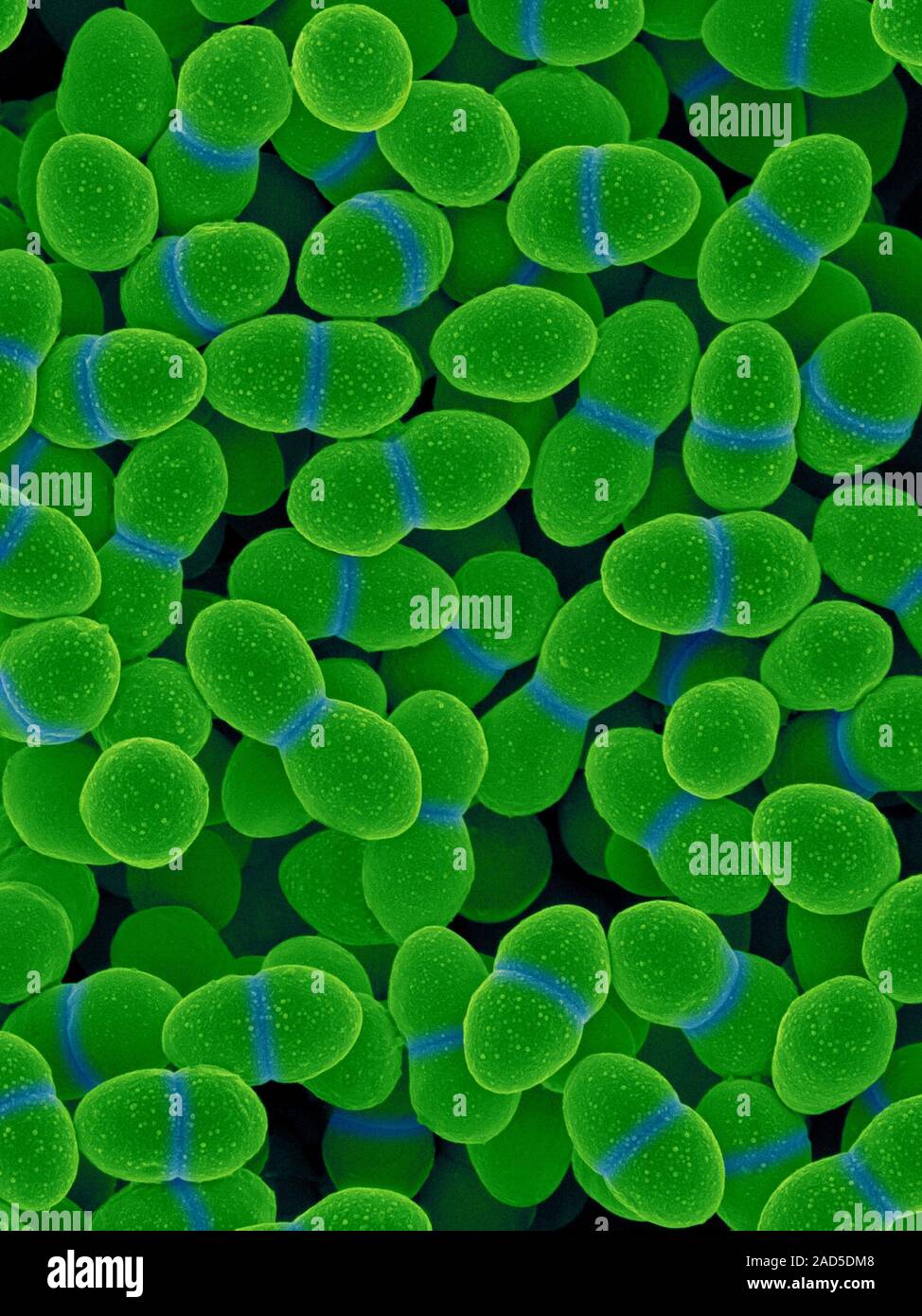 Coloured scanning electron micrograph (SEM) of Enterococcus faecalis ...