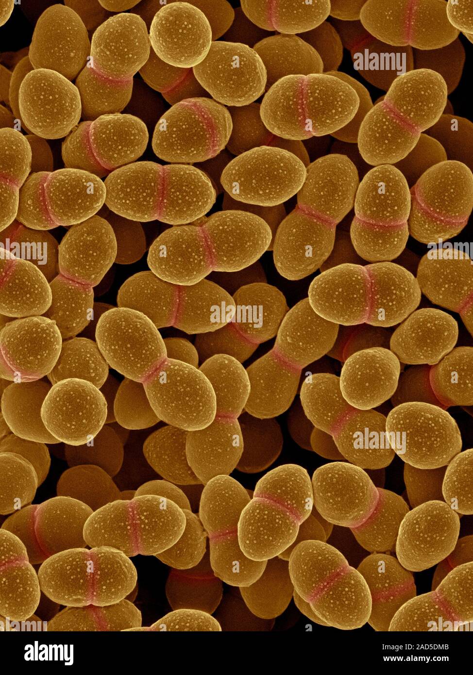 Coloured scanning electron micrograph (SEM) of Enterococcus faecalis ...