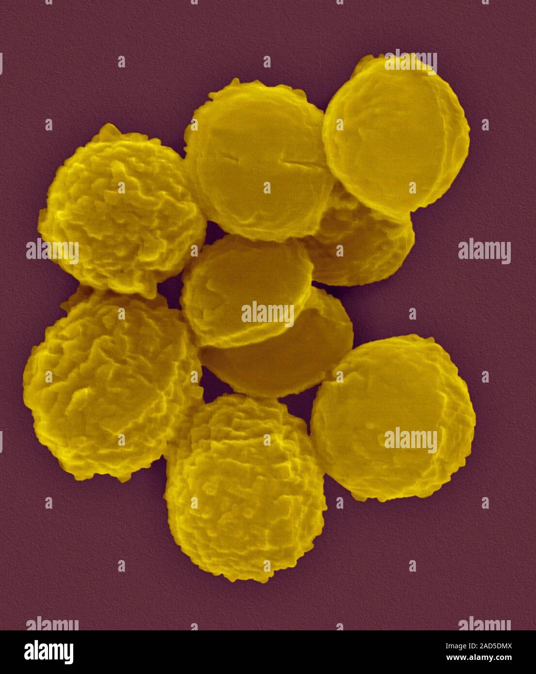 Coloured scanning electron micrograph (SEM) of Micrococcus luteus, gram ...