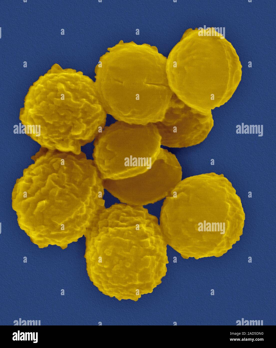 Coloured scanning electron micrograph (SEM) of Micrococcus luteus, gram ...