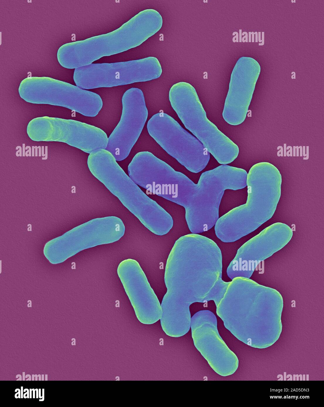 Coloured scanning electron micrograph (SEM) of Methylobacterium ...