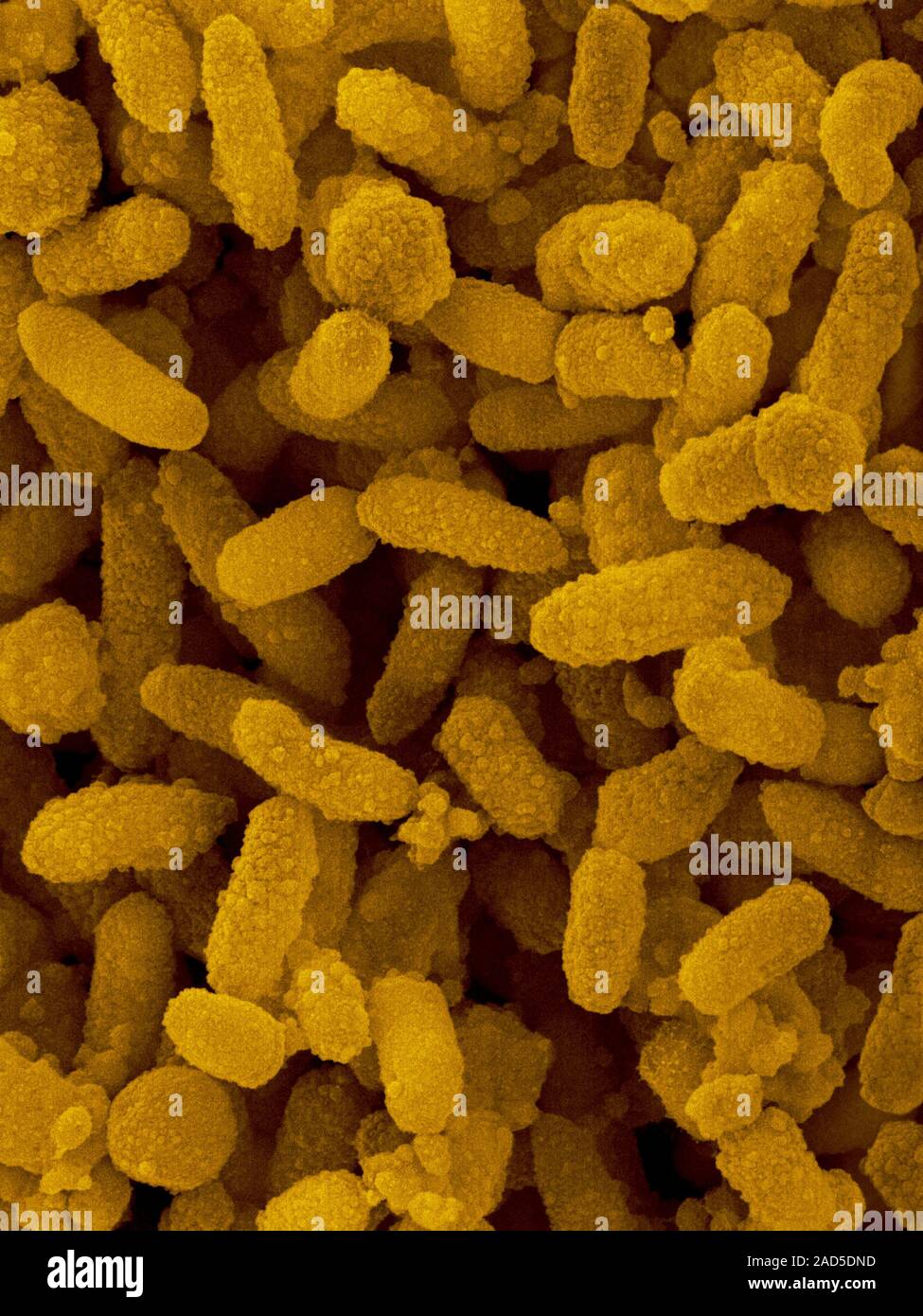 Coloured scanning electron micrograph (SEM) of Aeromonas hydrophila ... Coloured scanning electron micrograph (SEM) of Aeromonas hydrophila ...