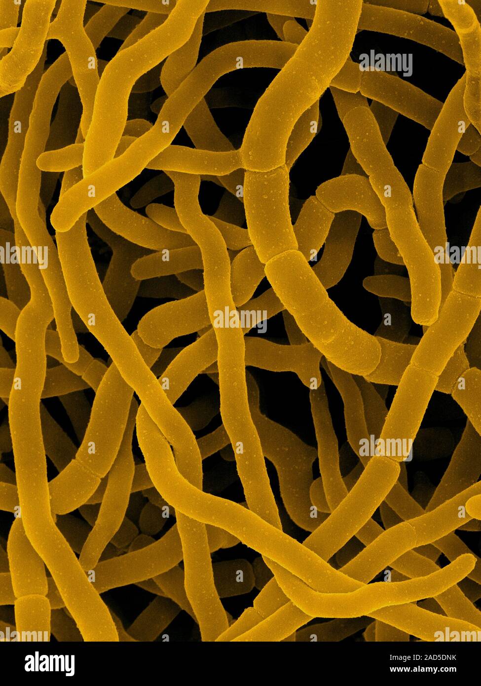 Coloured scanning electron micrograph (SEM) of Streptomyces rimosus ...