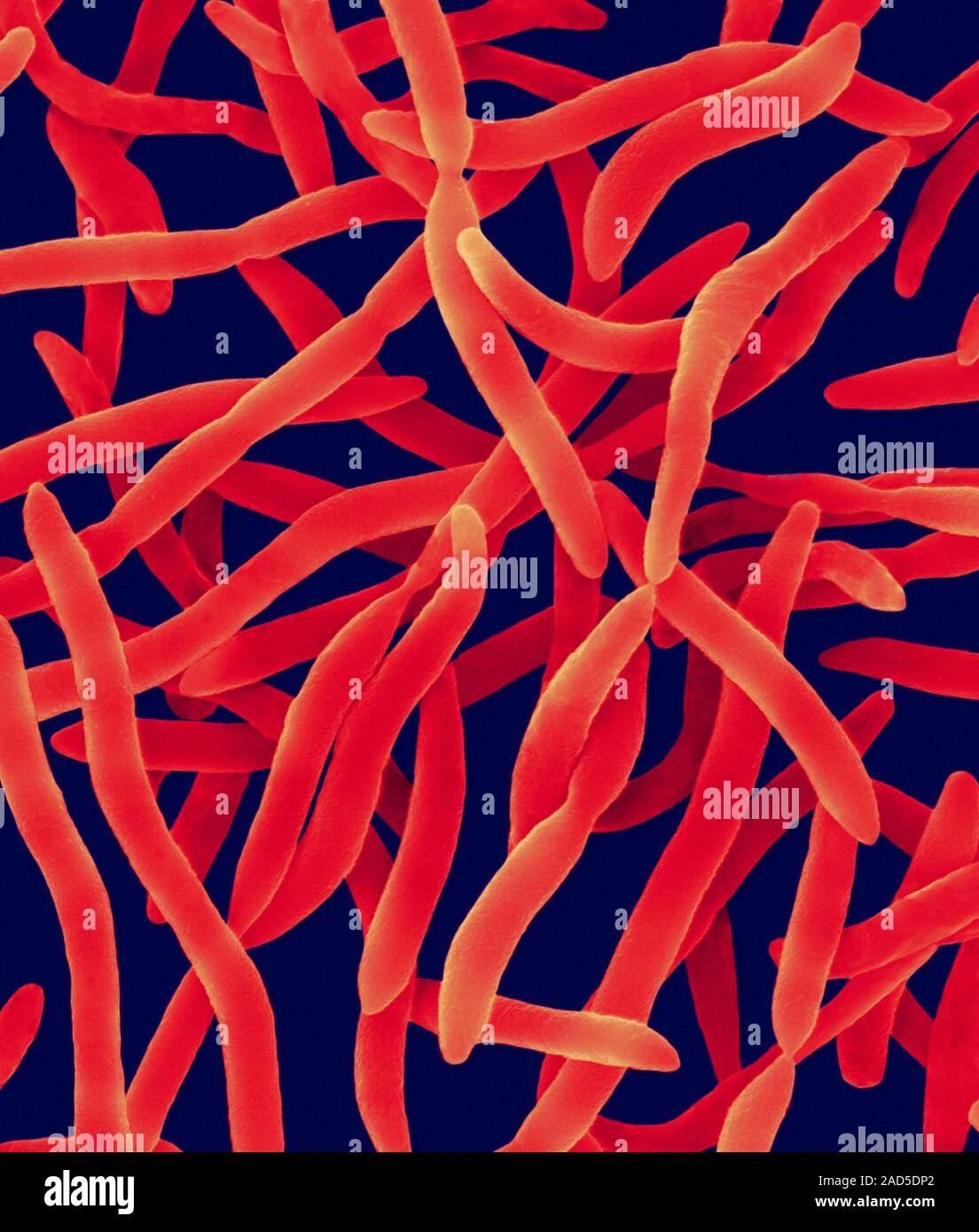 Coloured scanning electron micrograph (SEM) of Rhodospirillum rubrum ...