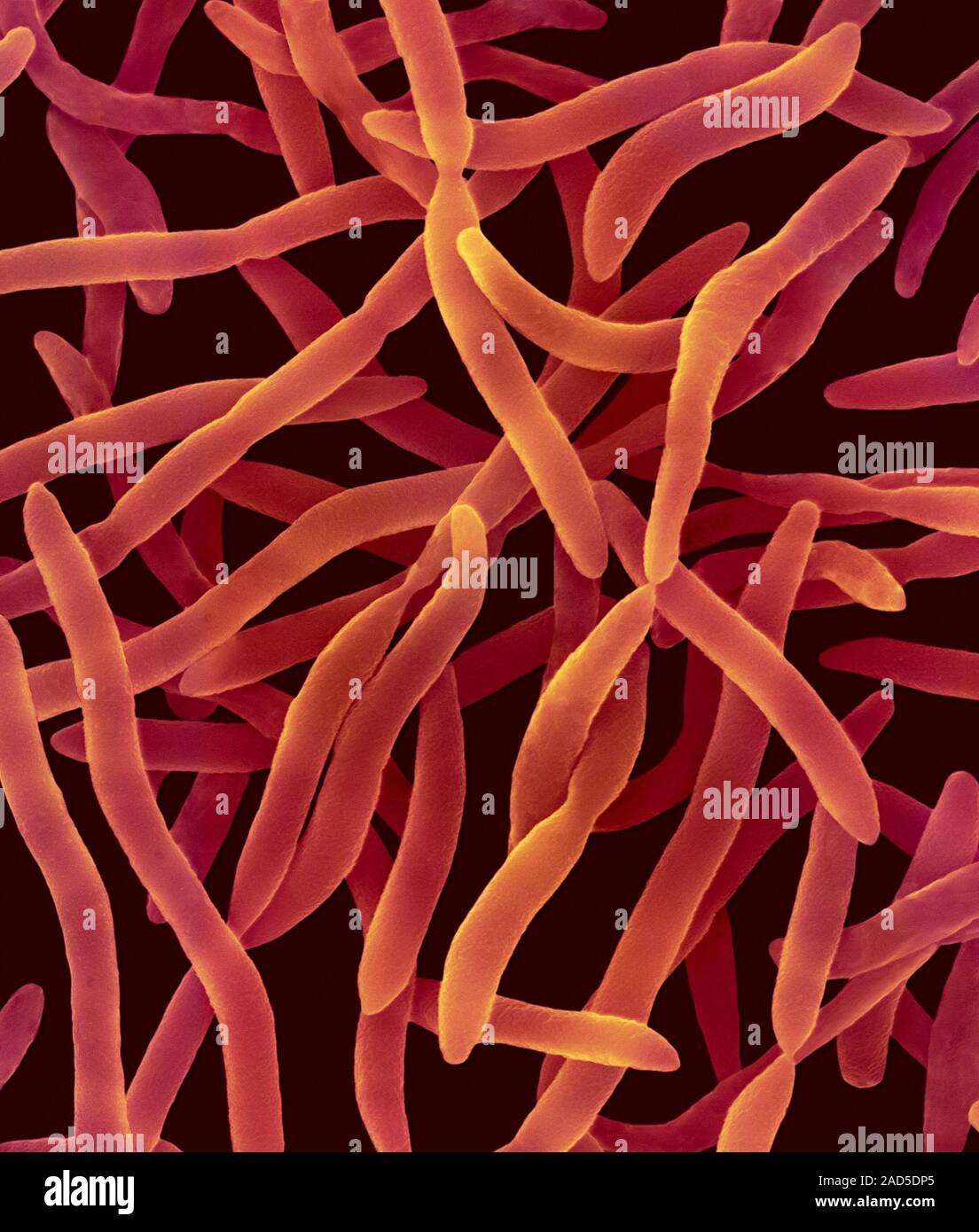 Micrograph Of Prokaryote