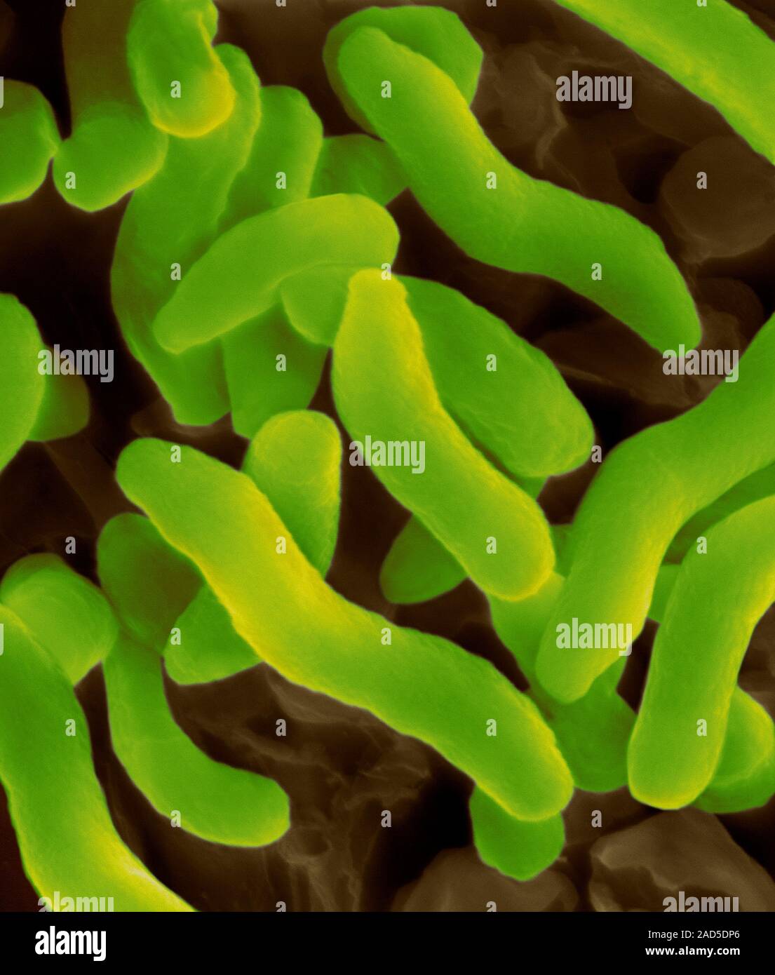 Coloured scanning electron micrograph (SEM) of Desulfovibrio vulgaris ...