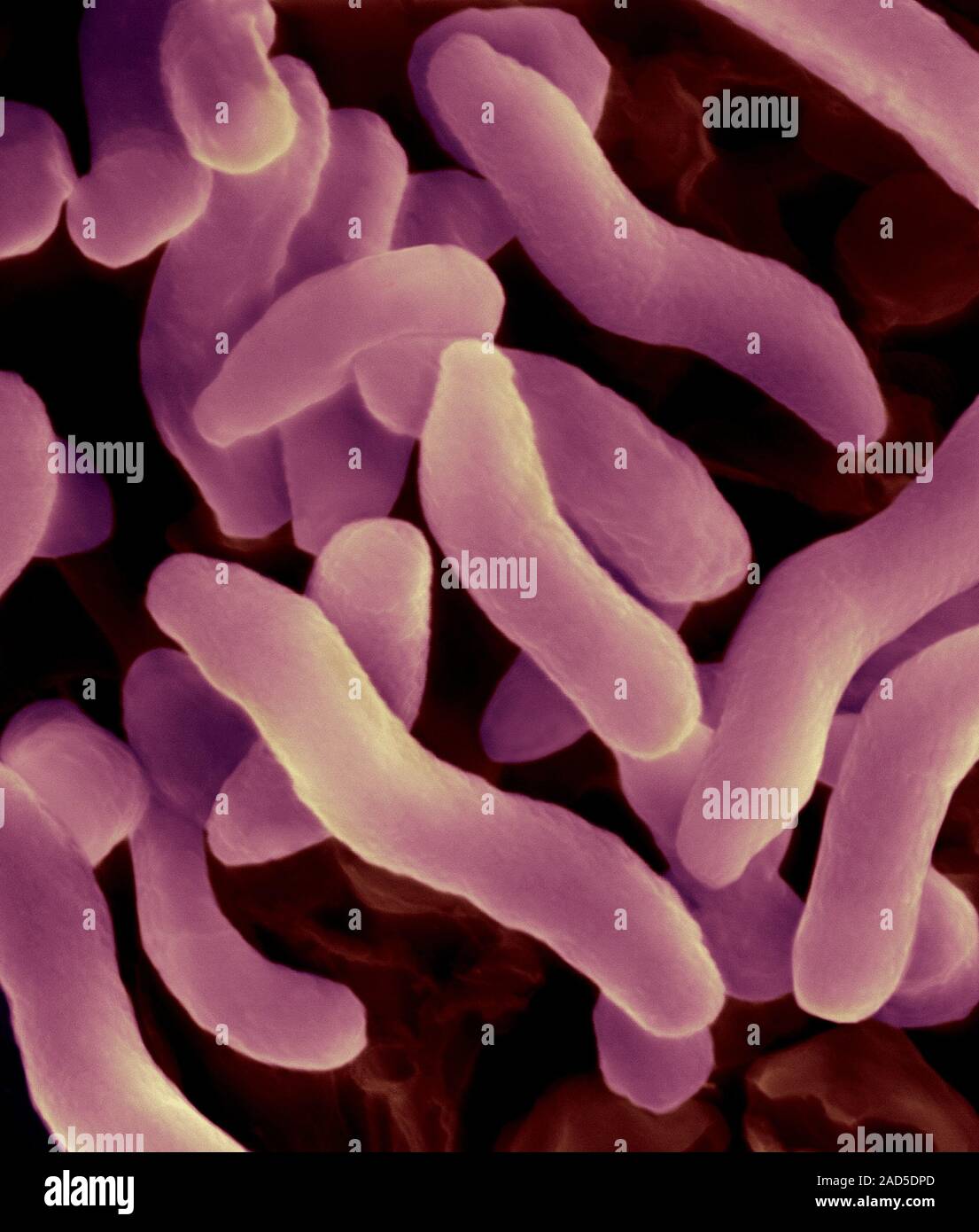 Coloured scanning electron micrograph (SEM) of Desulfovibrio vulgaris ...