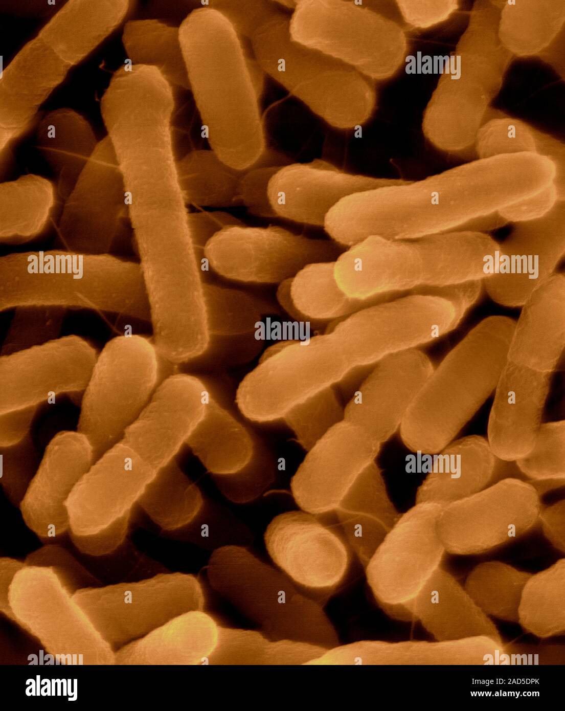 Coloured scanning electron micrograph (SEM) of Proteus vulgaris is a ...