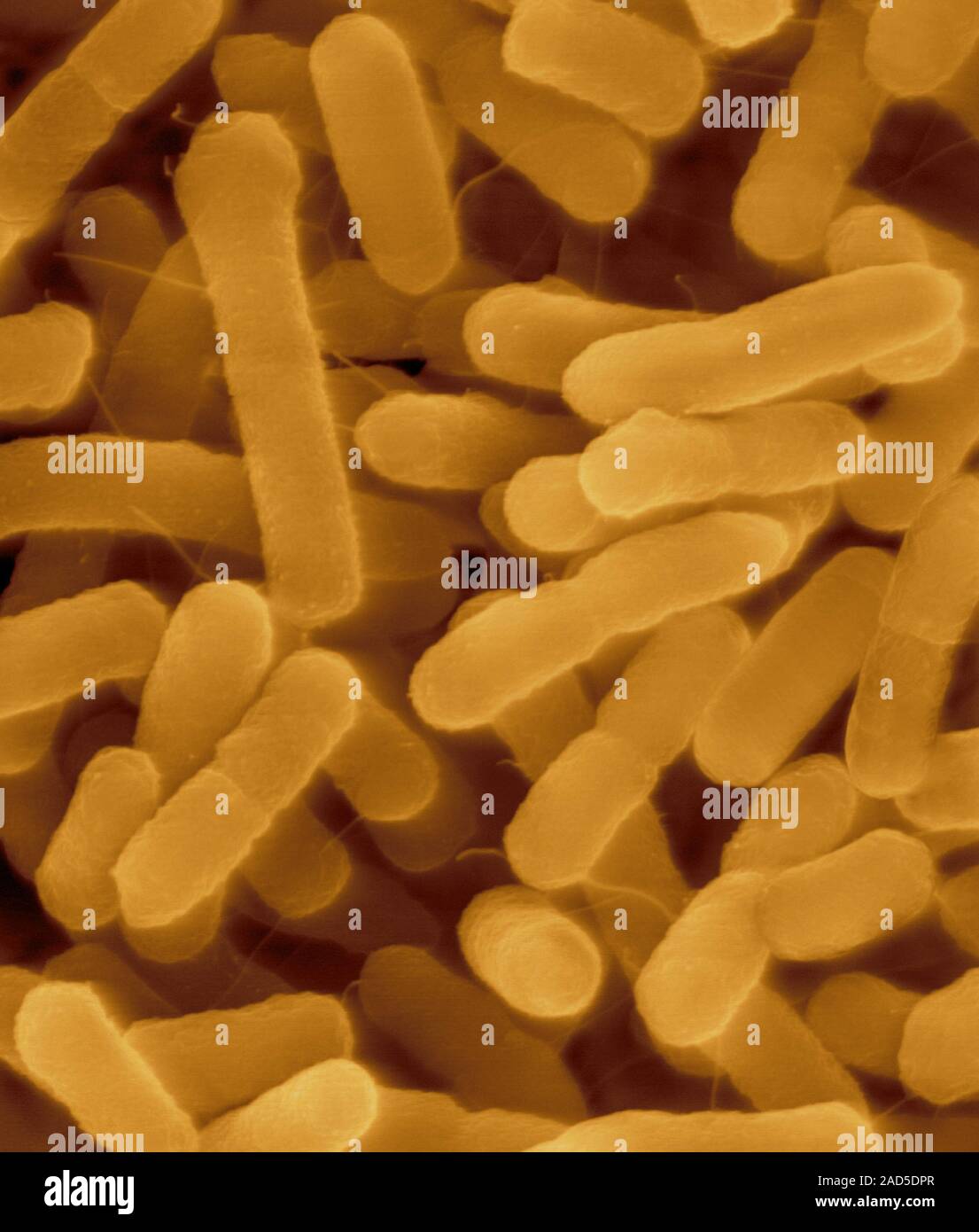 Coloured scanning electron micrograph (SEM) of Proteus vulgaris is a ...