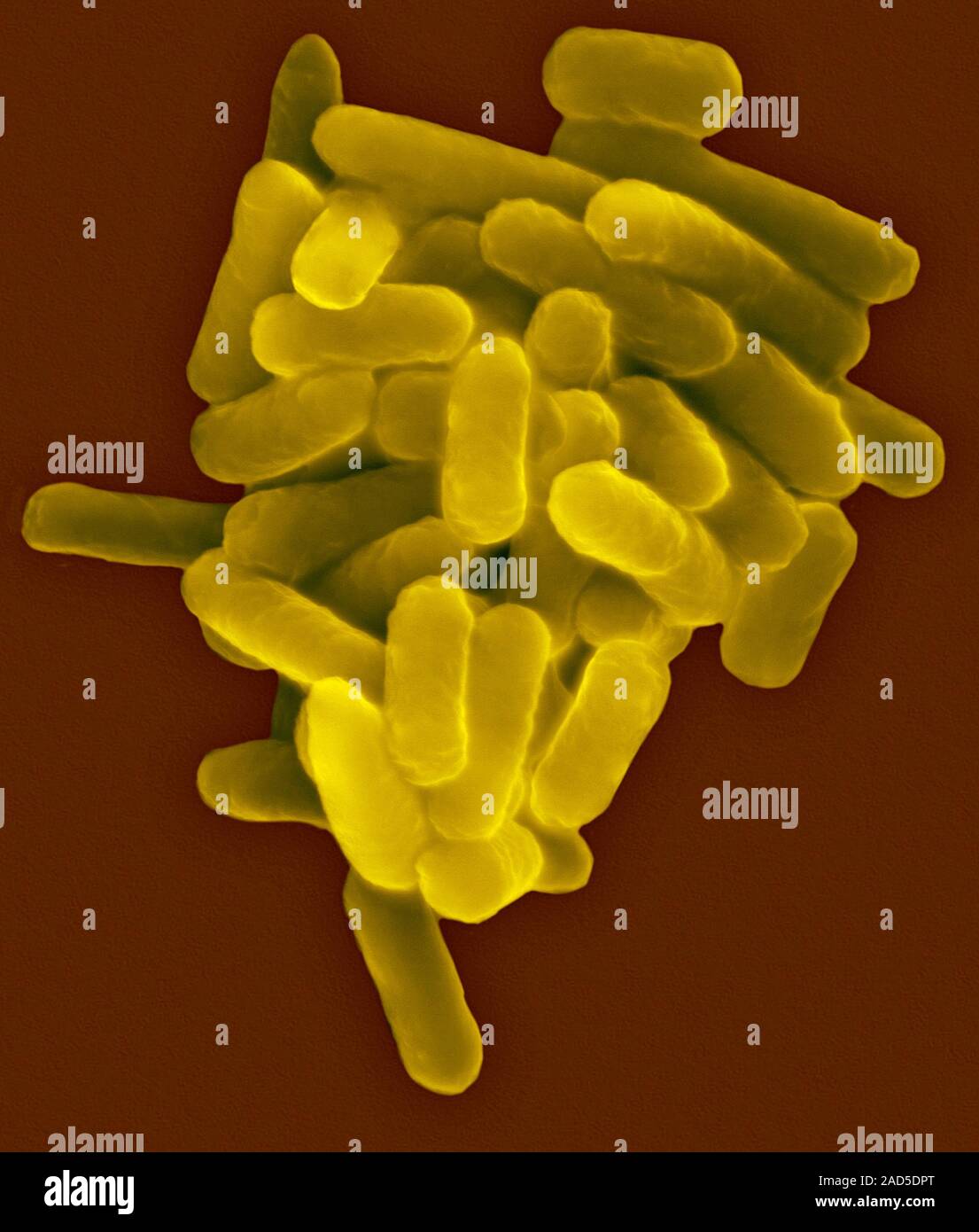 Coloured scanning electron micrograph (SEM) of Klebsiella pneumoniae ...