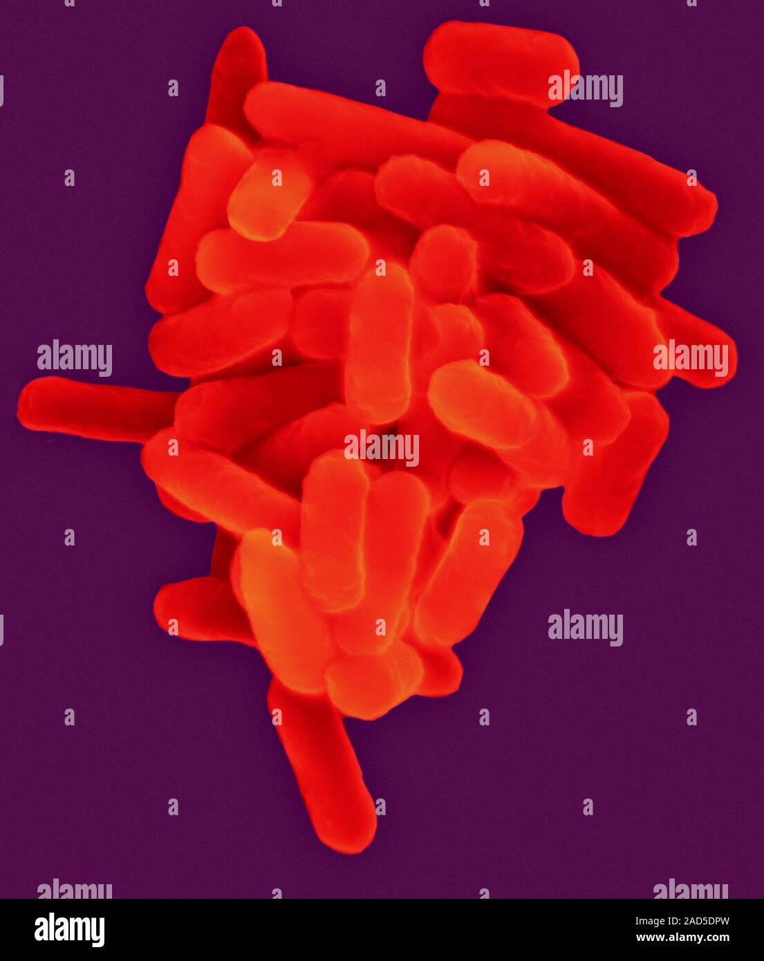 Coloured scanning electron micrograph (SEM) of Klebsiella pneumoniae ...