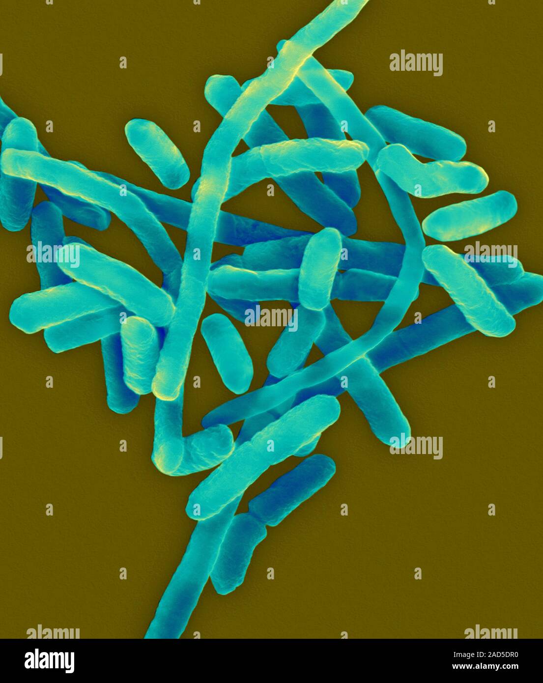 Coloured scanning electron micrograph (SEM) of Citrobacter freundii ...