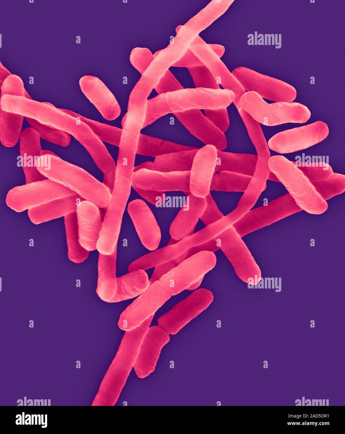 Coloured scanning electron micrograph (SEM) of Citrobacter freundii ...